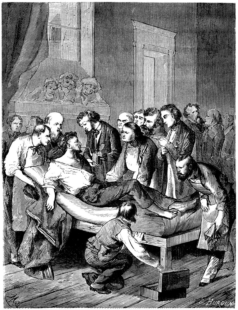 First surgical operation with sulfuric ether anesthesia at Boston ...