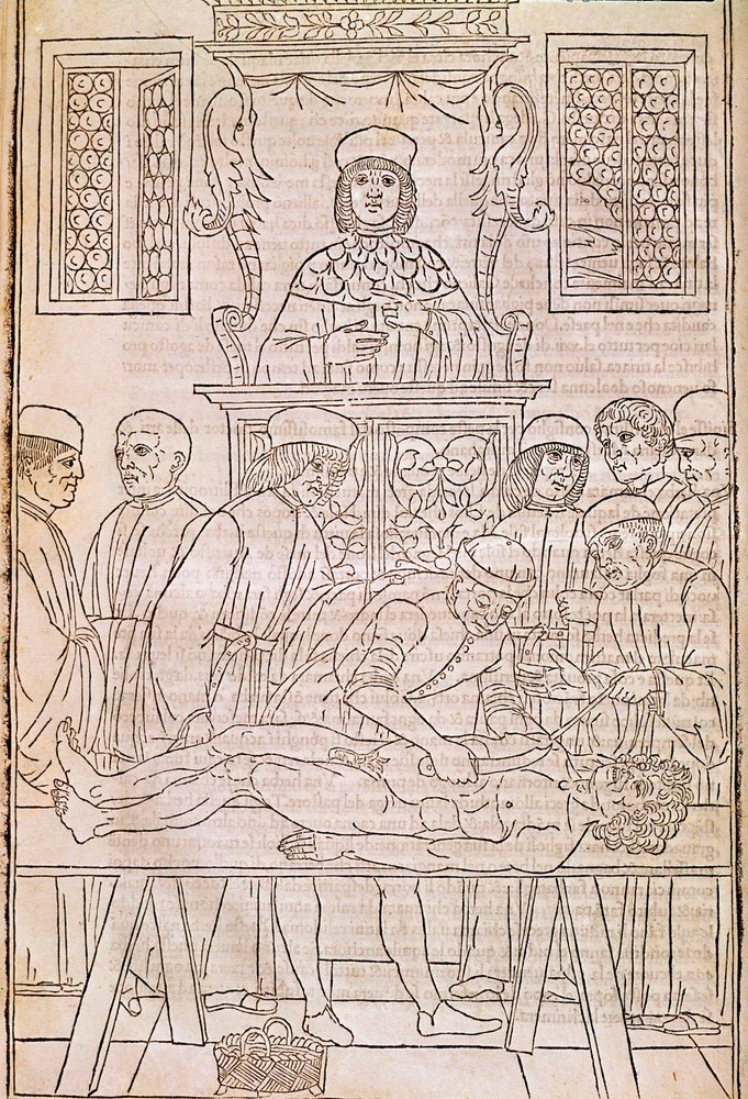 Autopsy. The body of a dead man dissected by doctors for an anatomy ...