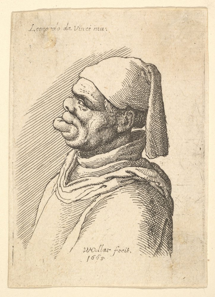 Bust of a Deformed Man with a Hat and a Fat, Protruding Lower Lip in ...