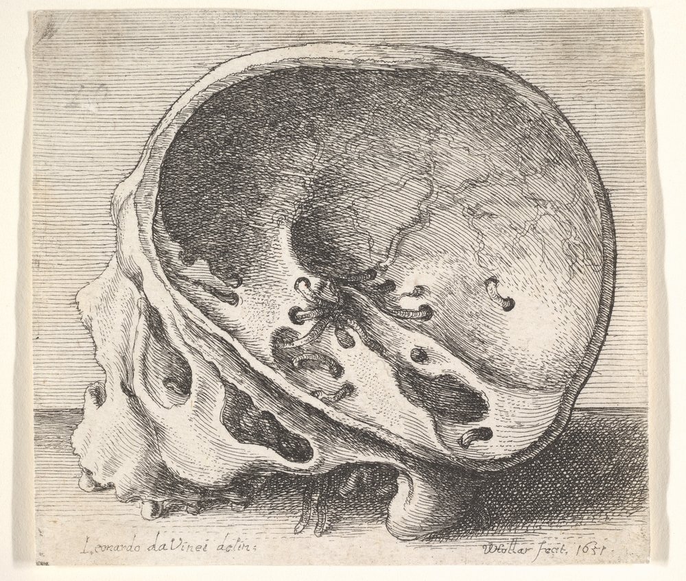 Sectioned Skull in Profile to Left with the Left Side of the Cranium ...