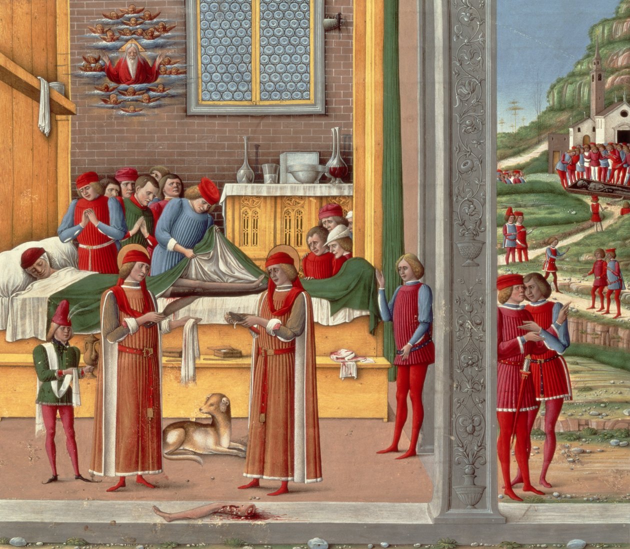 Medieval amputation scene by Italian School