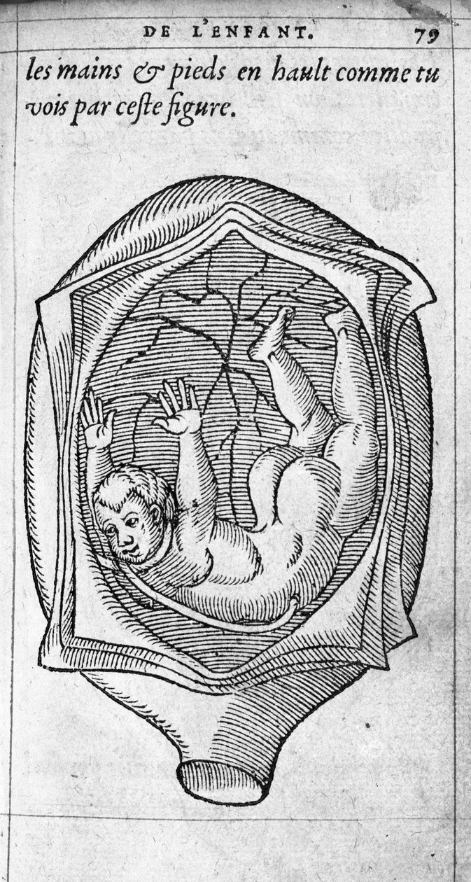 Pregnant Uterus Drawing The Position Of The Fetus In The Uterus During