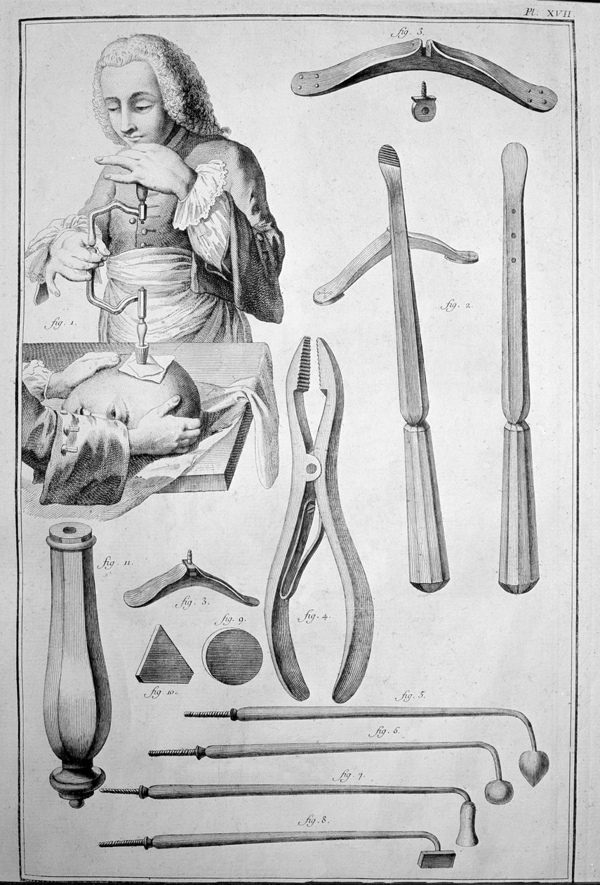 Trepanation of the Skull, Various Instruments