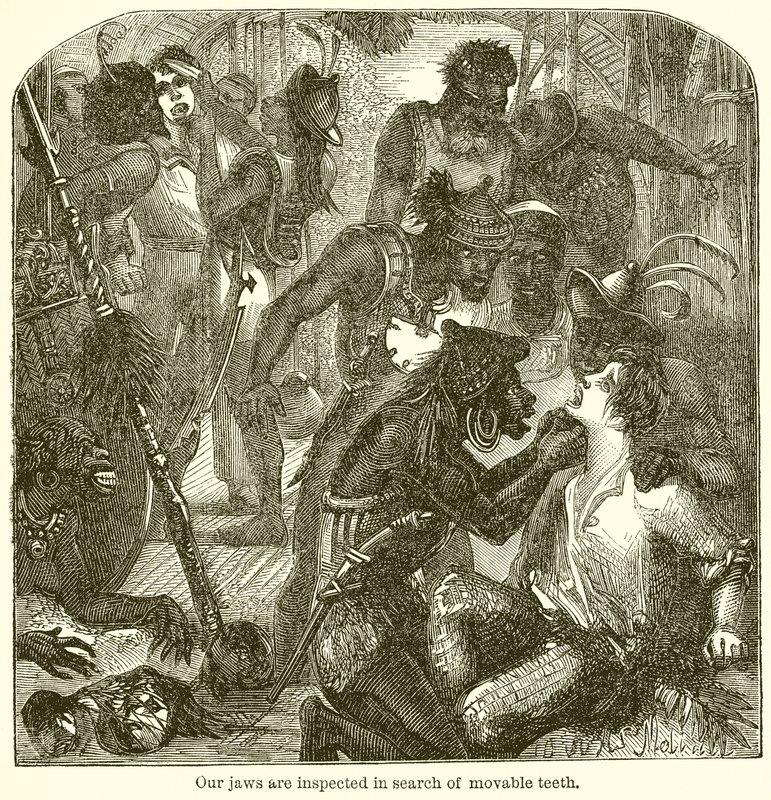 Our Jaws are Inspected in Search of Movable Teeth